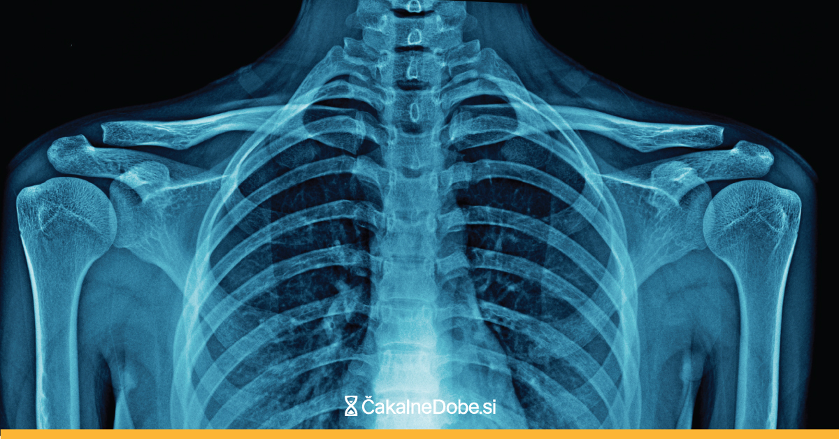 Rentgen in rentgenska preiskava - Čakalne dobe