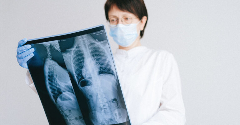 Kdaj je čas za pulmološki pregled in kako poteka? - Čakalne dobe